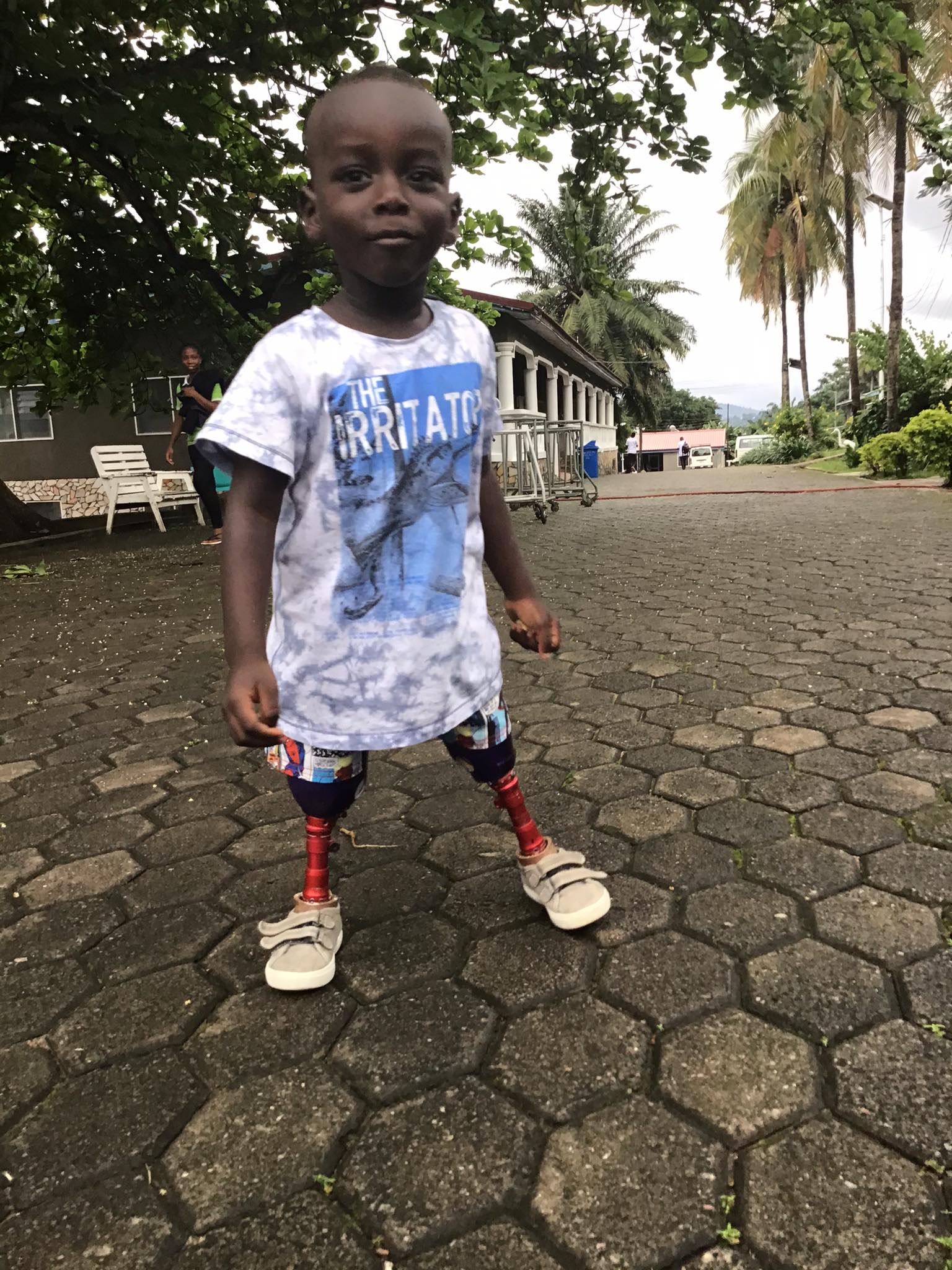 Two Prosthetic Legs : Two Bilateral Amputtee Boys (Kobby and Emmanuel ...